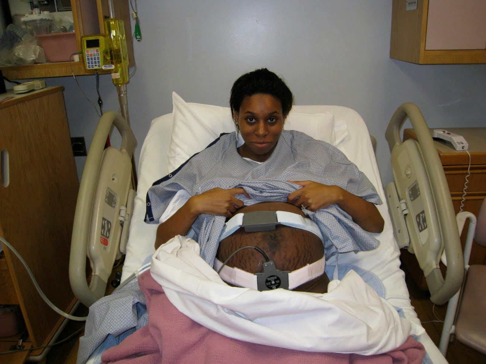 Why I Absolutely Loved Having A C-Section