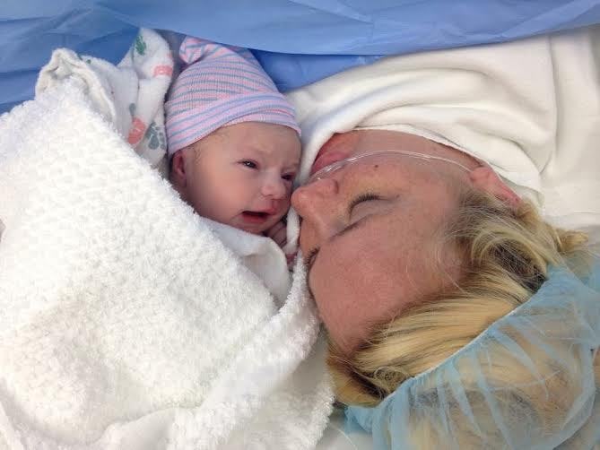 My C-Section Incision Finally Healed — 10 Months After My Baby Was Born