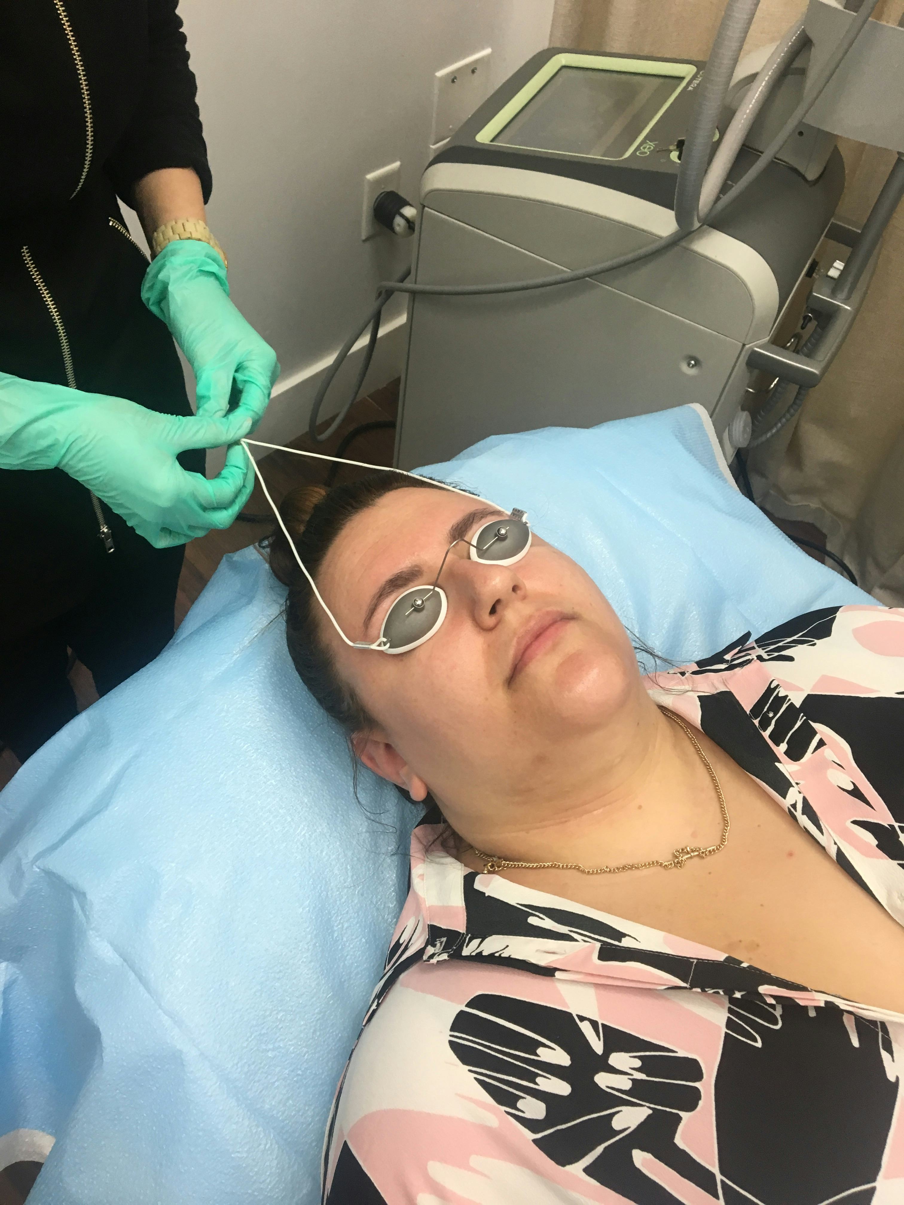 I Got A Laser Facial In Miami Like A Celebrity Goddess & Here's ...