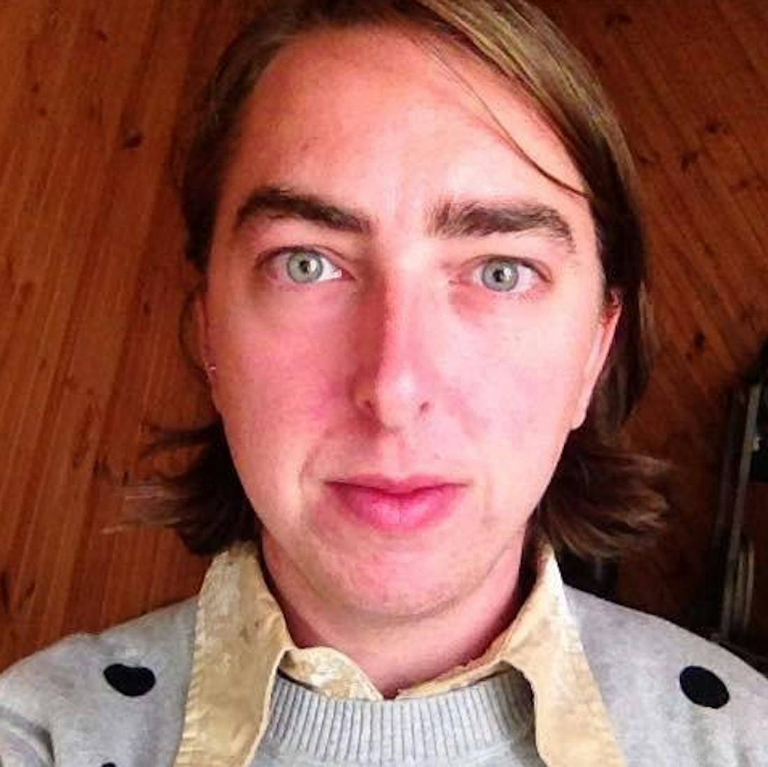 5 Trans Men On Why They're Proud Of Their Top Surgery Scars