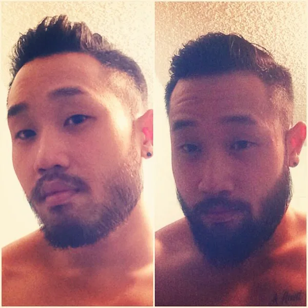 Before-And-After Photos Prove Men Always Look Better With Beards