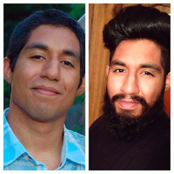 Before-And-After Photos Prove Men Always Look Better With Beards