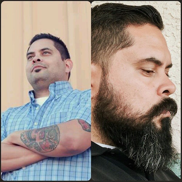 Before-And-After Photos Prove Men Always Look Better With Beards