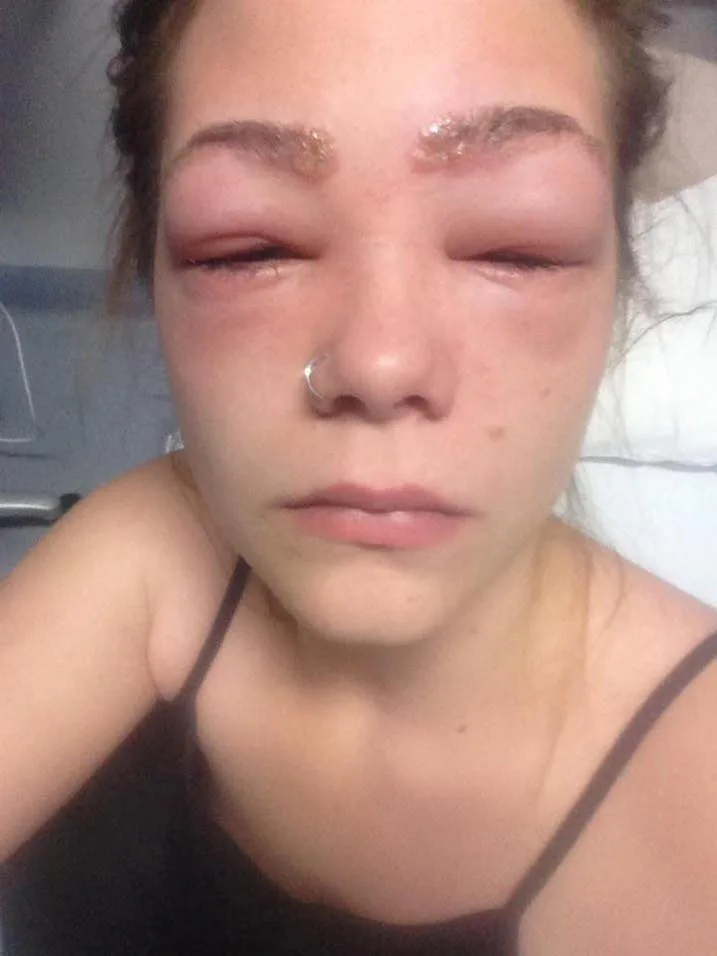Teen's Side-By-Side Pics Show Reaction To Eyebrow Tint