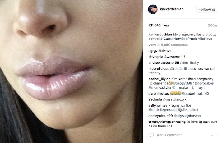 Beyoncé Fans Think She Got Lip Injections After Recent Pics