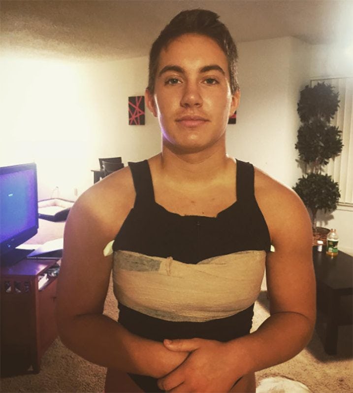 Trans Man's Before And After Photos Show Transition Process