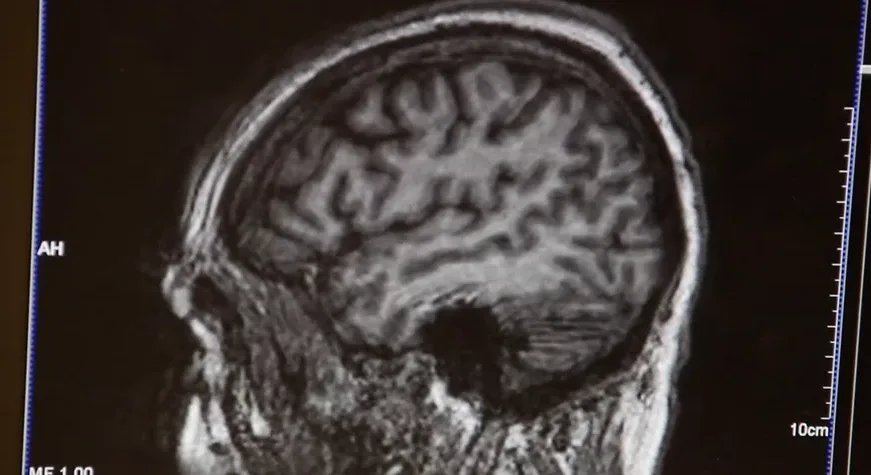 The Unconscious Brain Is Made Up of Unconnected Islands, Say Scientists