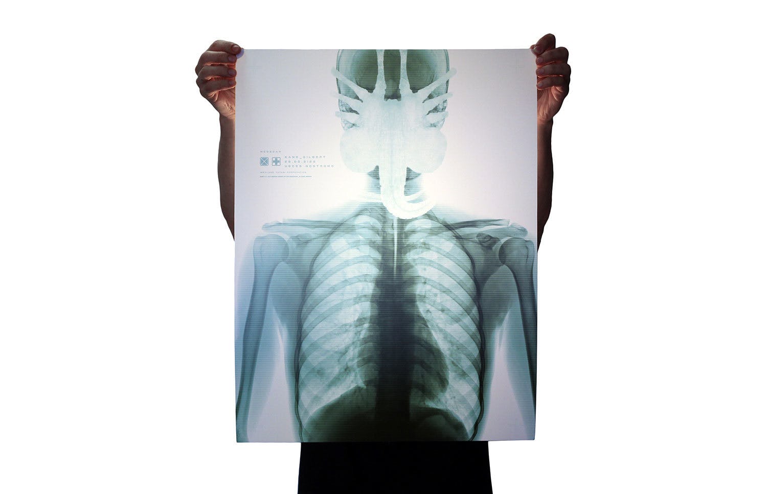 Mondo Tears 'Alien Day' Limb From Limb