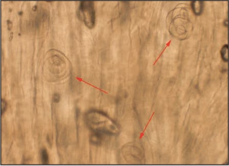 Parasite in California Boar Meat Literally Makes Your Eyes Bleed