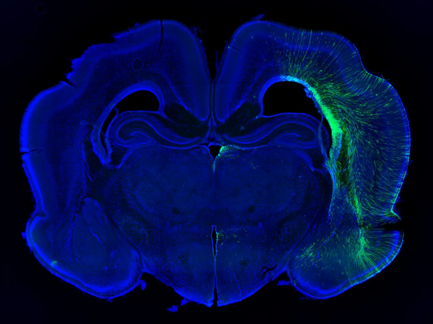 Mutant Ferrets With Tiny Brains Give Clues to Evolution of Human Brains