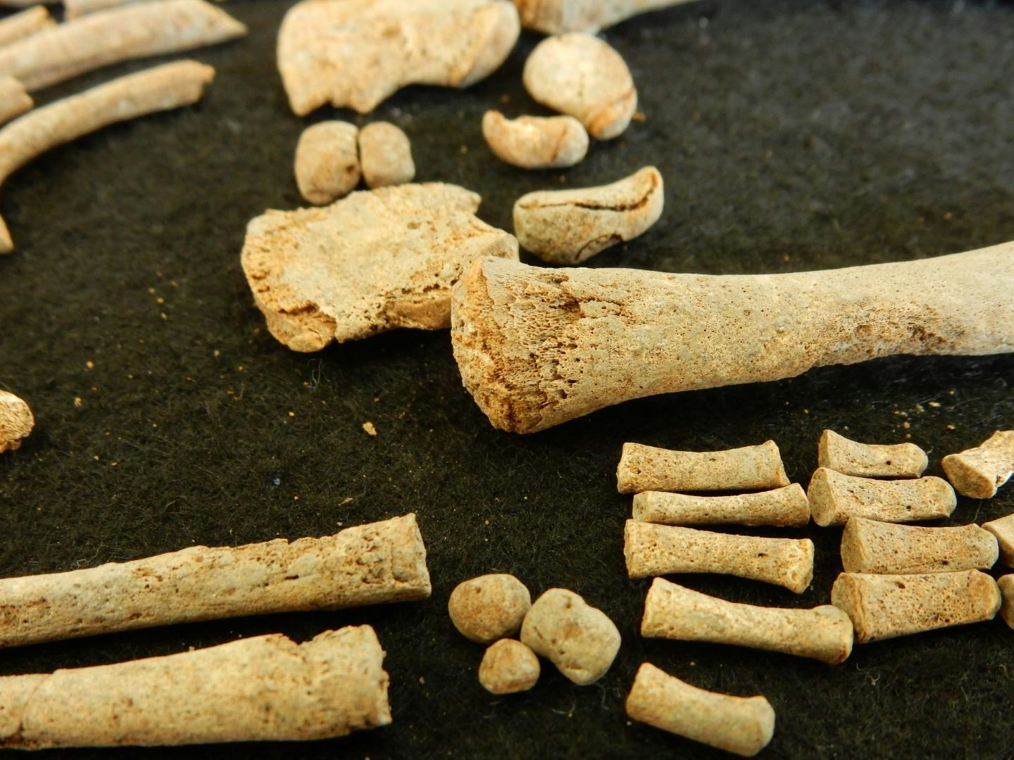 Oldest-Ever Syphilis DNA Sequenced From Convent Cemetery Skeletons
