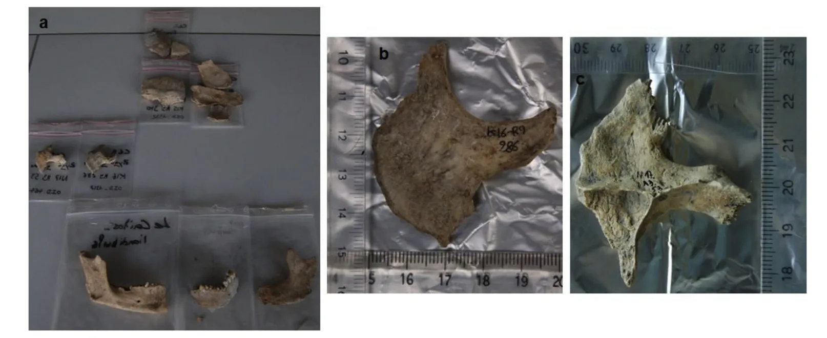 Ancient Celts Embalmed Severed Heads in Present-Day France, Study Finds