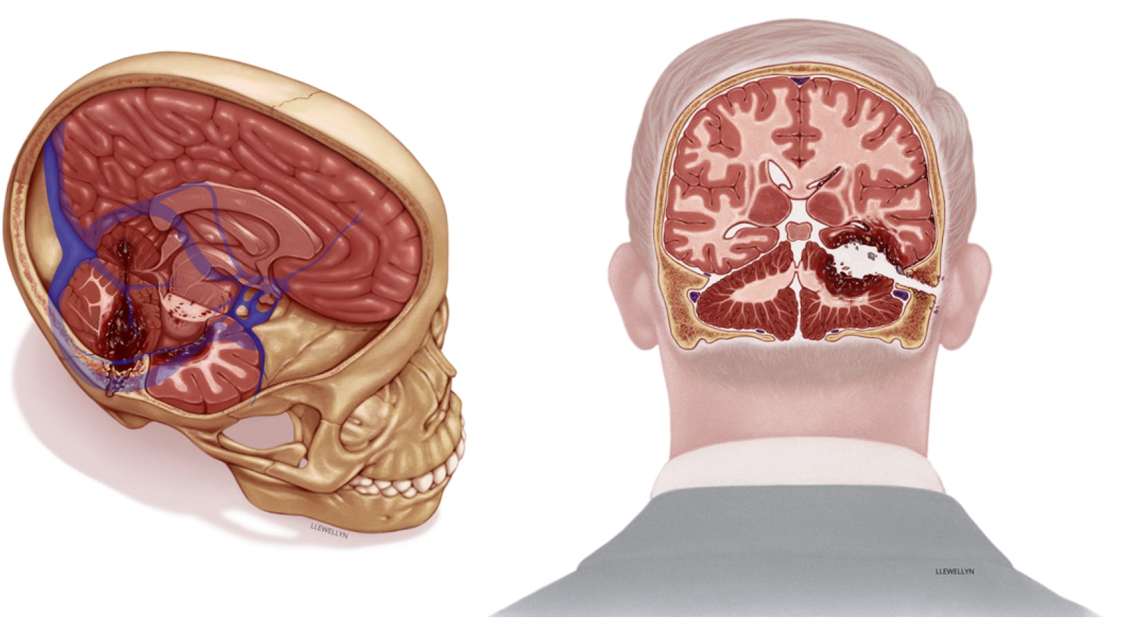 Robert F. Kennedy: New Assassination Details Revealed in Medical Analysis