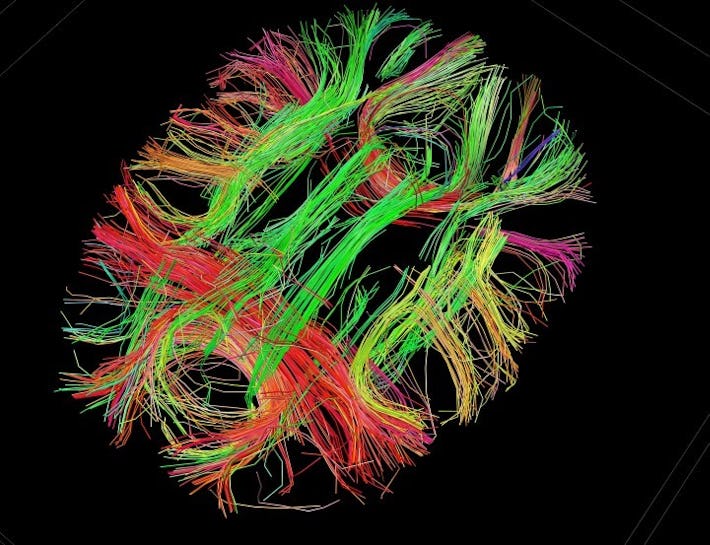 The Human Connectome Project Is Turning Brain Scans Into the New ...