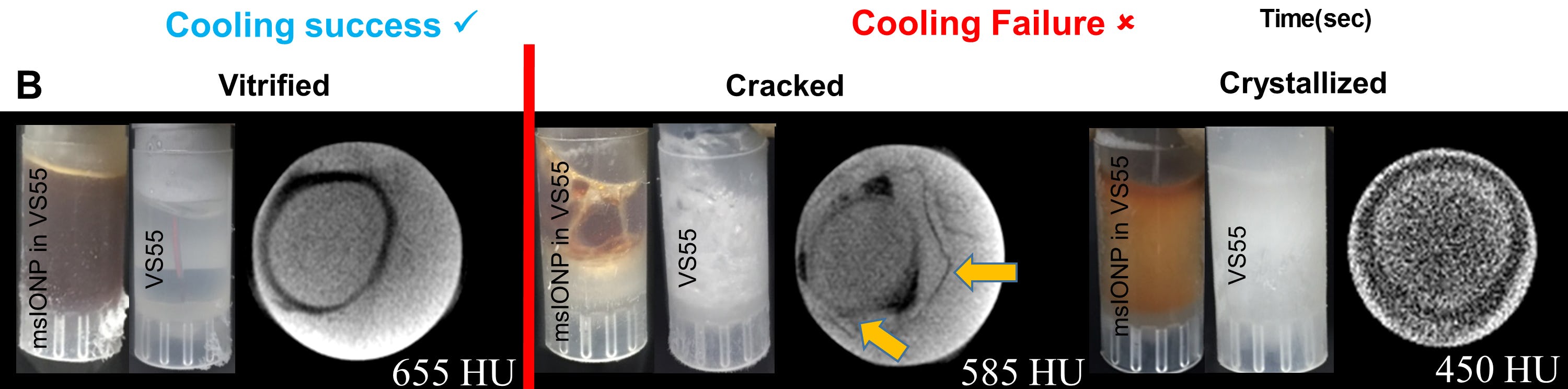 Cryogenic Preservation of Vitrified Human Organs Is Now Inevitable