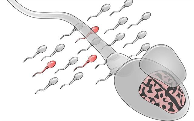 Mutations in sperm are linked to diseases. Do fathers really want to know?