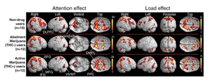 What Your Brain Actually Looks Like on Different Drugs