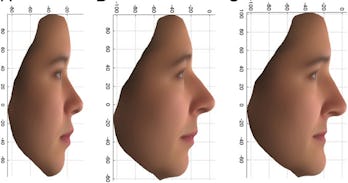 Human Faces Are Most Affected by These Three Genes, Study Finds