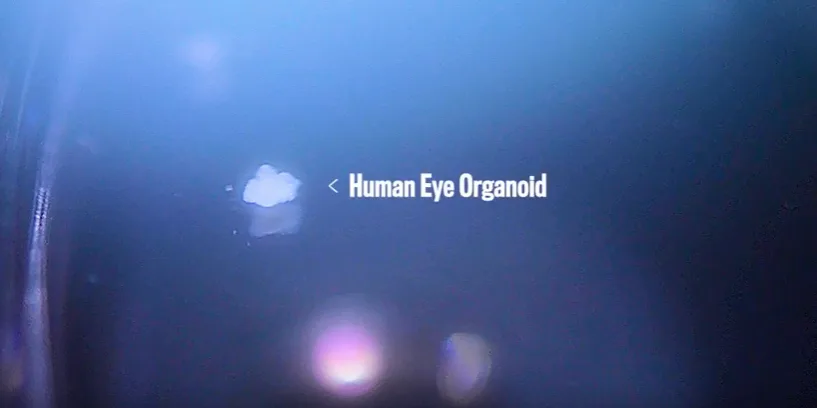 Lab-Grown Human Retinas Reveal Keys to Color Vision