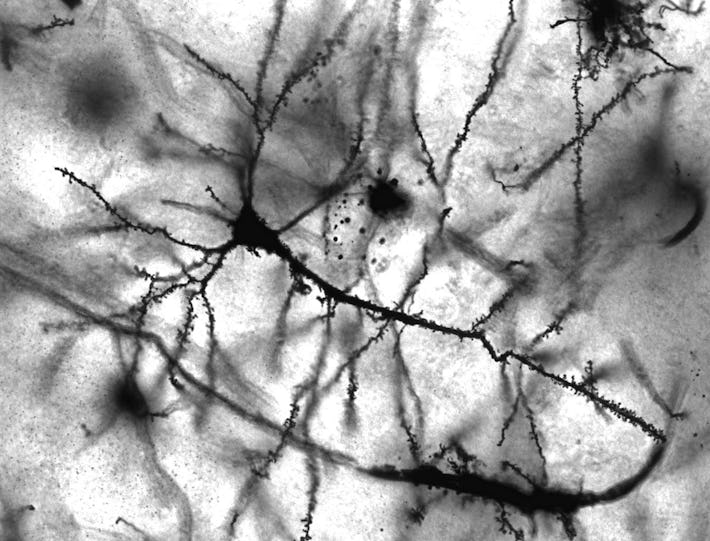 Kernel's Neural Implants Could Boost Failing Human Brains