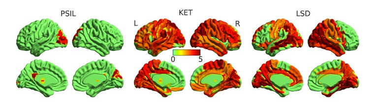 What Your Brain Actually Looks Like on Different Drugs