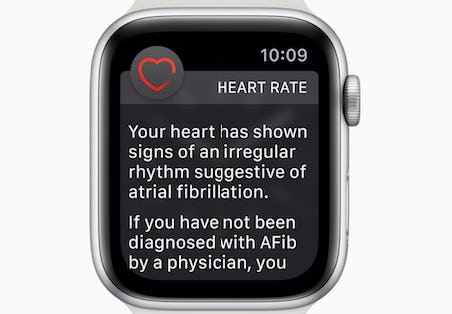 Apple Watch ECG Saved Man From “Silent" Atrial Fibrillation Heart Condition