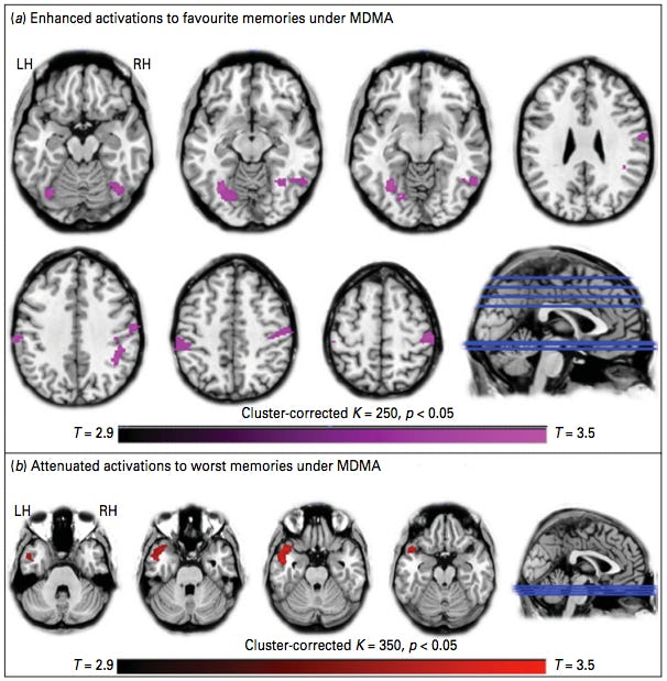 What Your Brain Actually Looks Like on Different Drugs