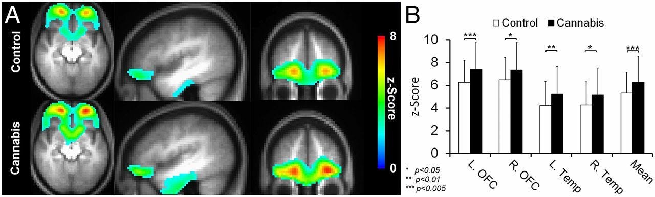 What Quitting Marijuana After 30 Years Does to Your Brain