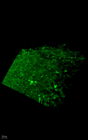 Scientists Grow Mini Brain Organoids From Stem Cells