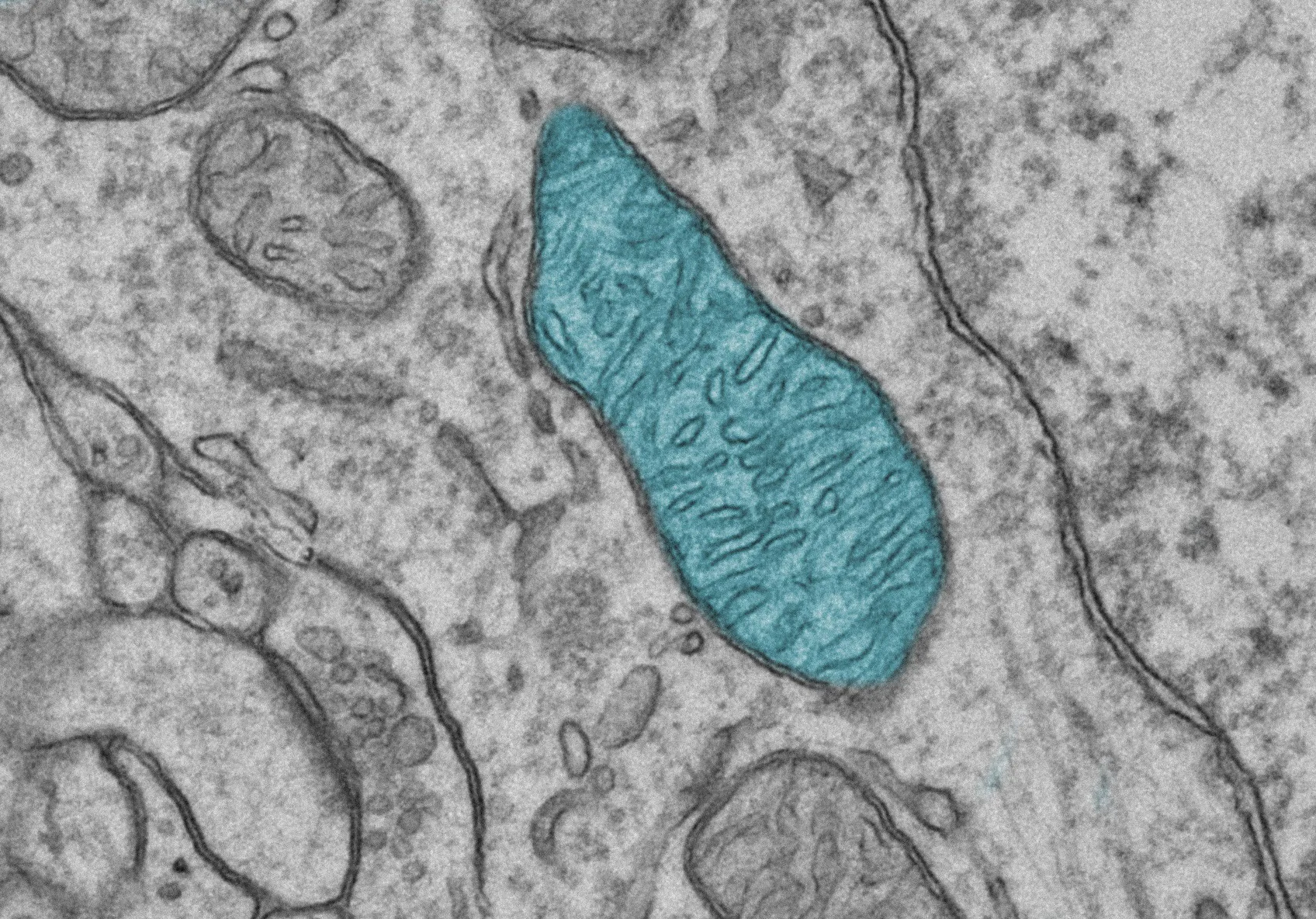 Panic attacks: Constant stress can literally reshape cells from the inside