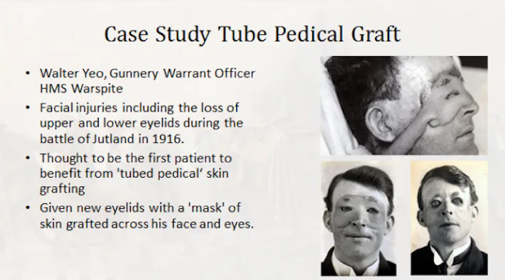 How WWI Injuries Led to a $16 Billion Plastic Surgery Industry