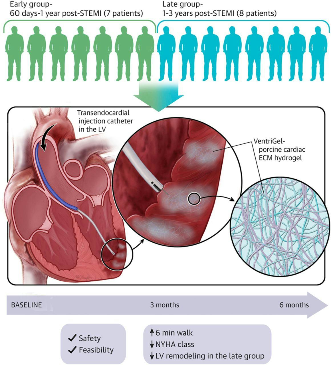Injectable Pig Heart Tissue Is the Future of Recovering From Heart Attacks