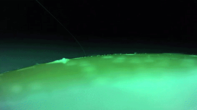 Will Neuralink Be Durable? Elon Musk’s Radical Idea Faces Historic Problem