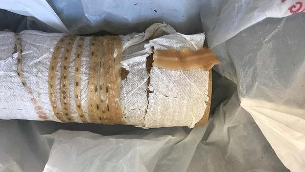 Yes, This Sushi-Obsessed Man Pulls 5-Foot Tapeworm Out of His Rectum
