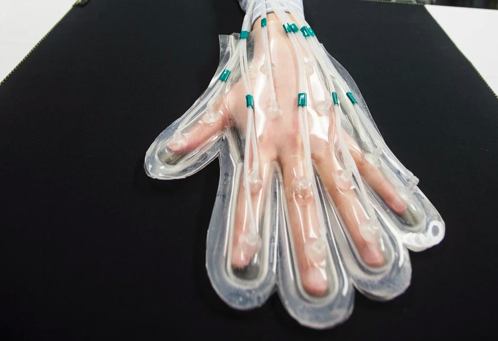 New Healing Glove Will Cause Us to 'Rethink How We're Dressing Wounds'