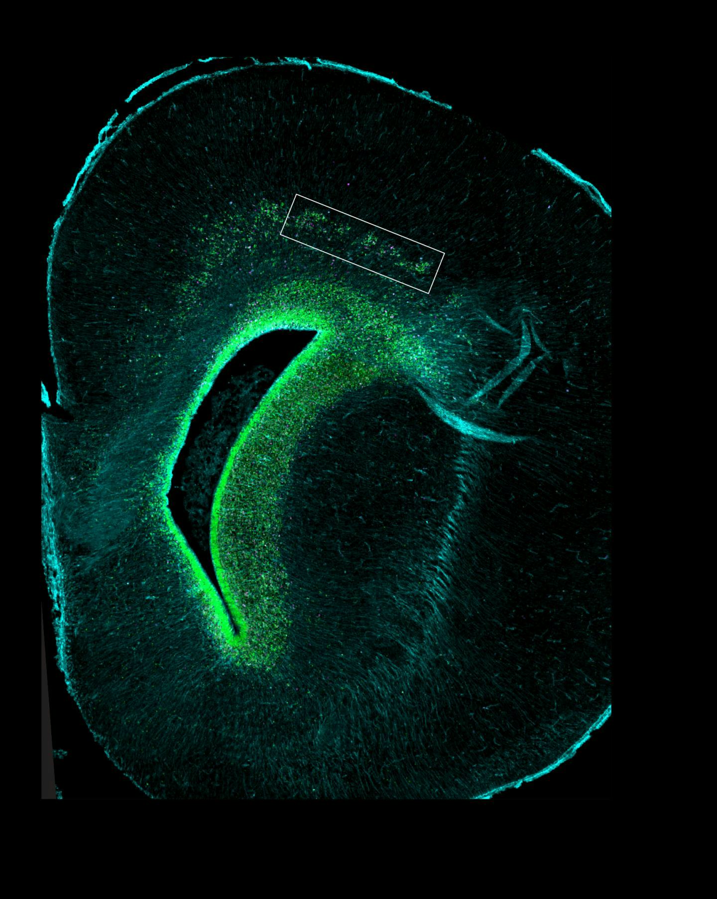 Mutant Ferrets With Tiny Brains Give Clues to Evolution of Human Brains