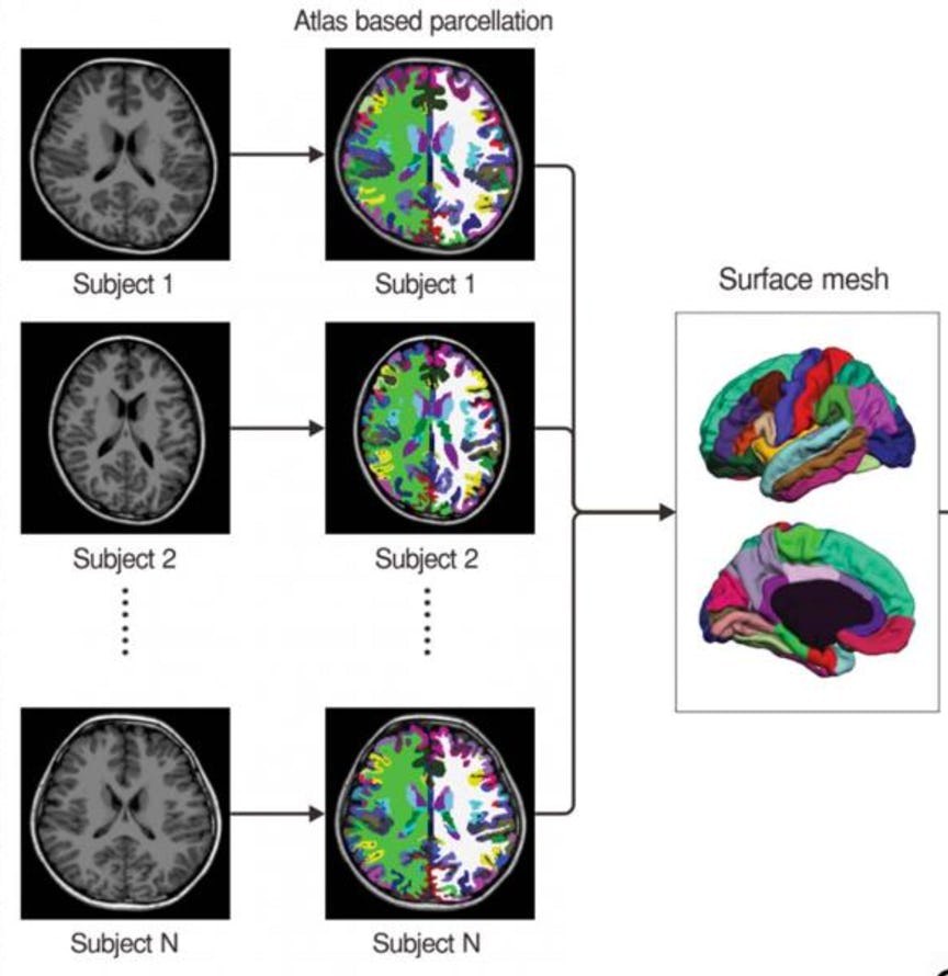 Study on the Brains of ADHD Patients Has Implications for the Adderall Boom