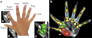 Six-fingered people exemplify why an extra digit means a better hand