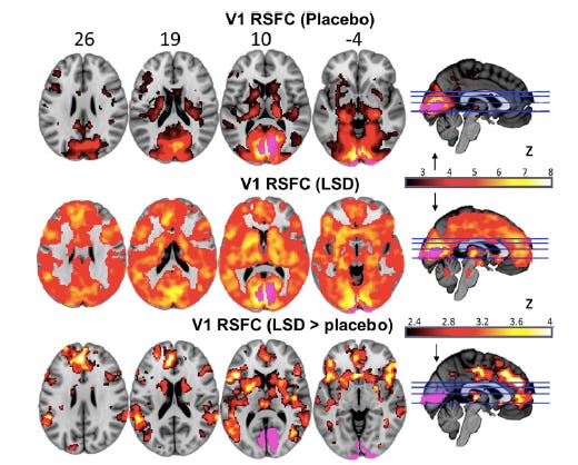 New Brain Images Show How LSD Affects Our Minds
