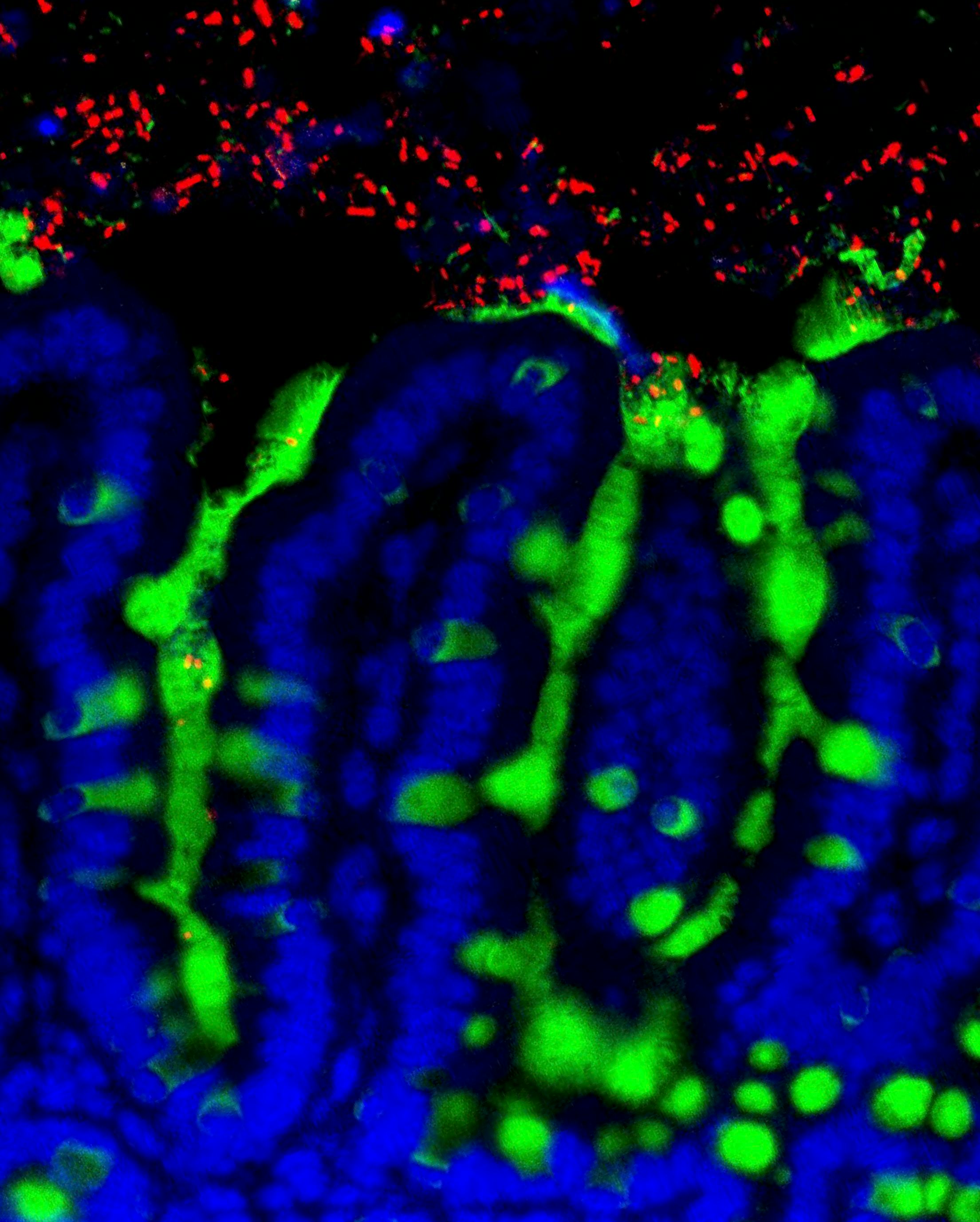 Milk Allergy? Scientists Find New Evidence That May Treat Food Sensitivity