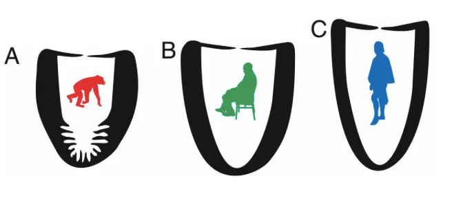 An “Ape-Like” Change in the Heart Is Preventable With 1 Type of Exercise