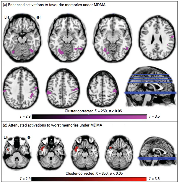 MDMA Successfully Treats PTSD in New Study, Scientists Eye FDA Approval