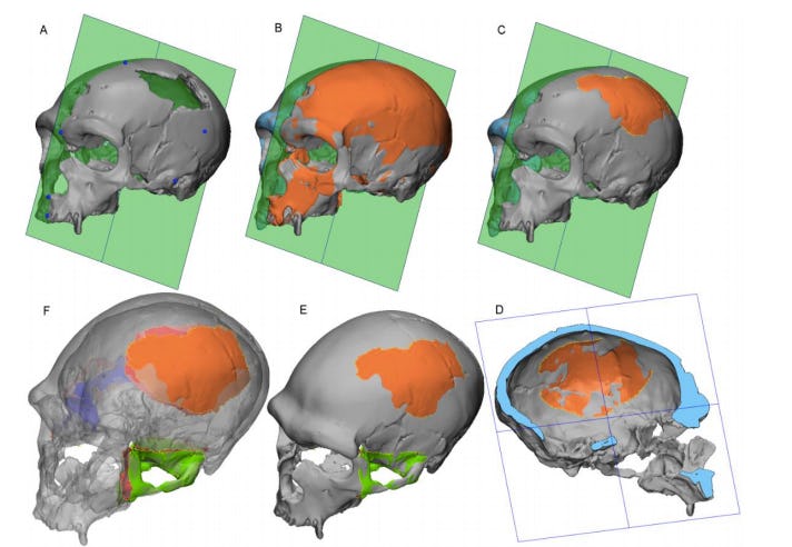 Neanderthals Were Capable of "Turbo Breathing" to Survive Ice Age