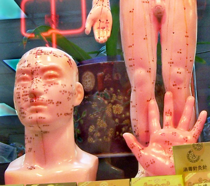 What Actually Happens to Your Body When You Get Acupuncture