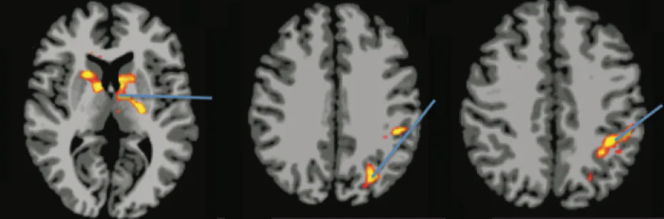 Neural Scans Show What Spiritual Experiences Look Like in the Brain