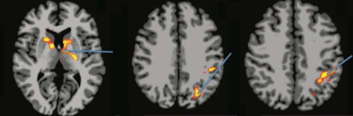 Neural Scans Show What Spiritual Experiences Look Like in the Brain