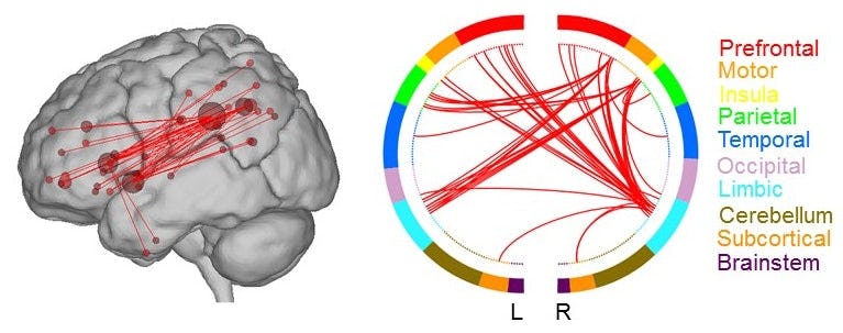 Neuroscience Explains Why Some People Are More Creative Than Others