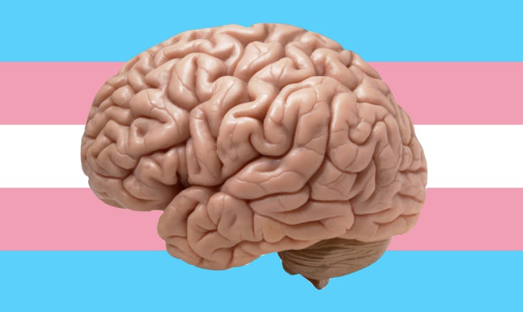 Brain Activity of Transgender People Reveals a Way to End Gender Dysphoria