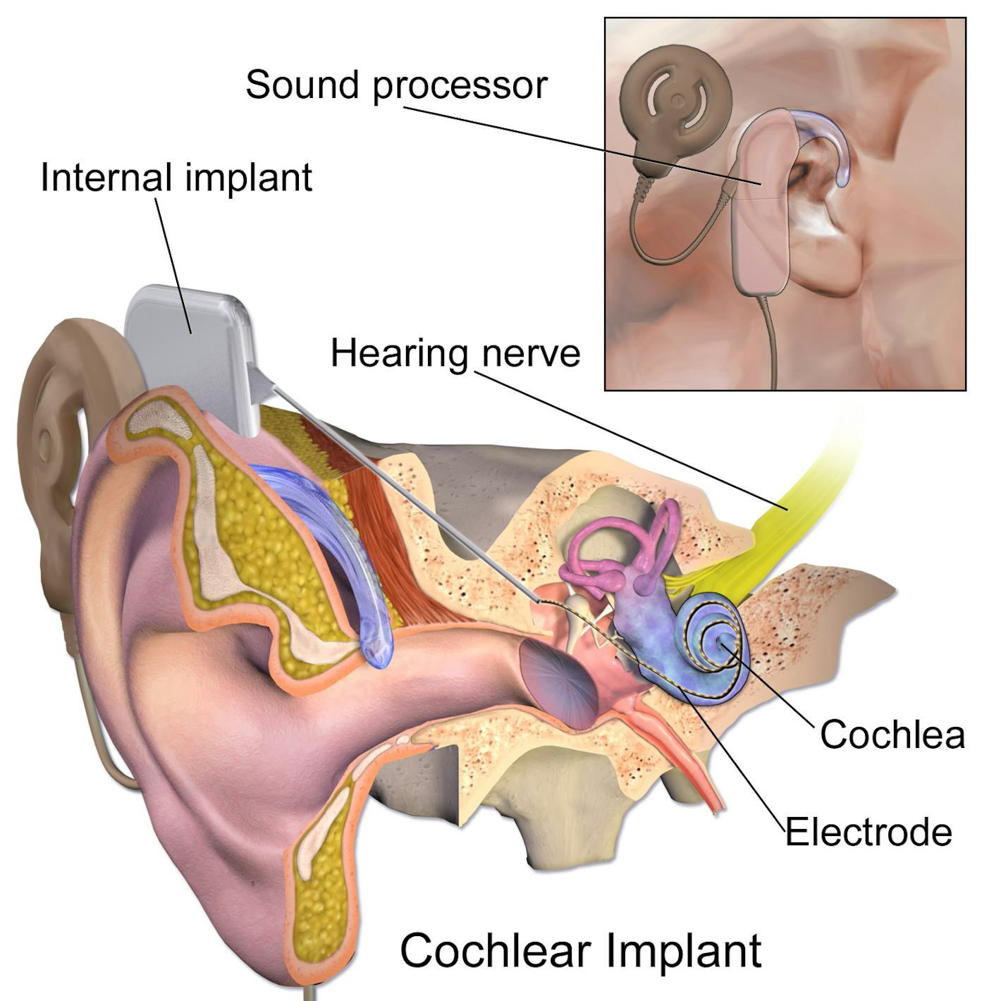Neural Implants Could Let Hackers Hijack Your Brain