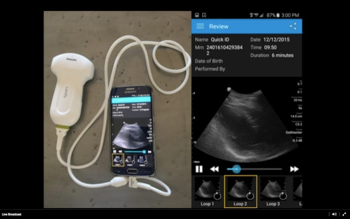 The Wearable Future of Space Medicine Phones Home For You